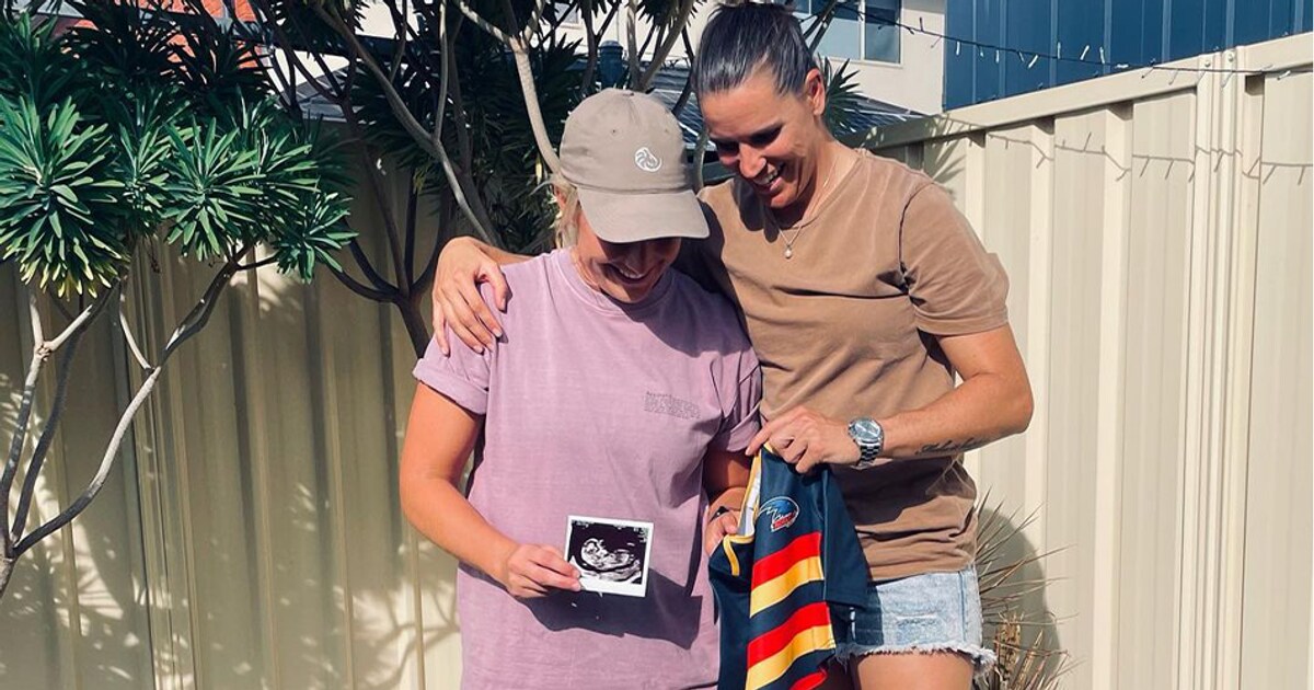 BCD: AFLW Captain Chelsea Randall and Marijana Rajcic’s baby news